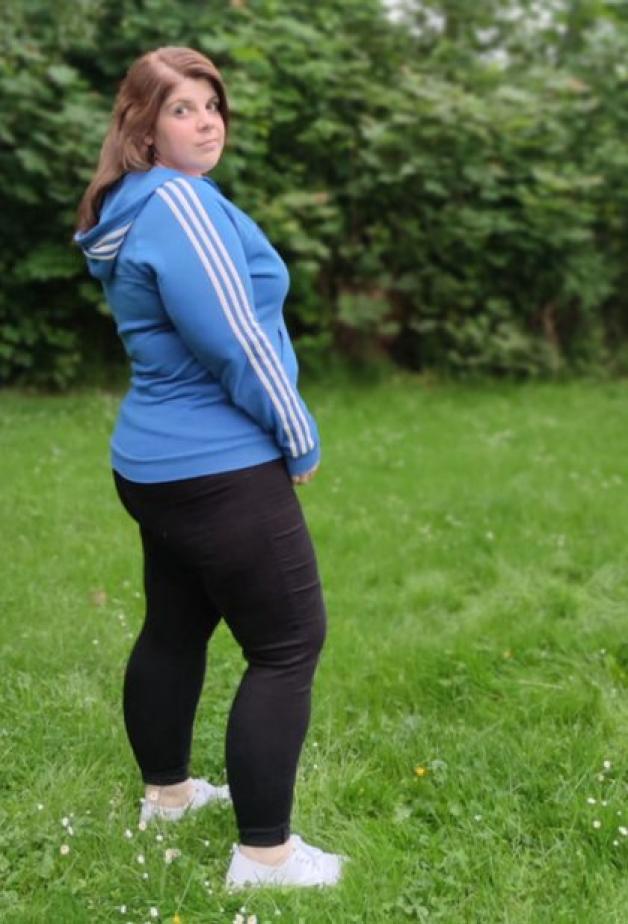 Koste, Ablauf, Risiken: Magenverkleinerung: