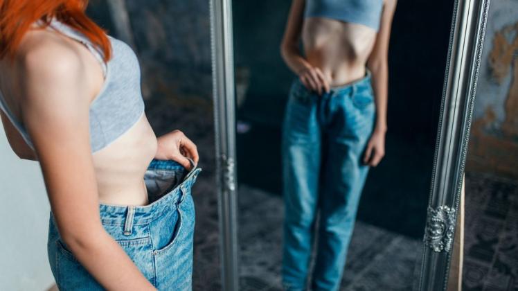 Magersucht Eine Junge Meppenerin Hungerte Sich Fast Zu Tode