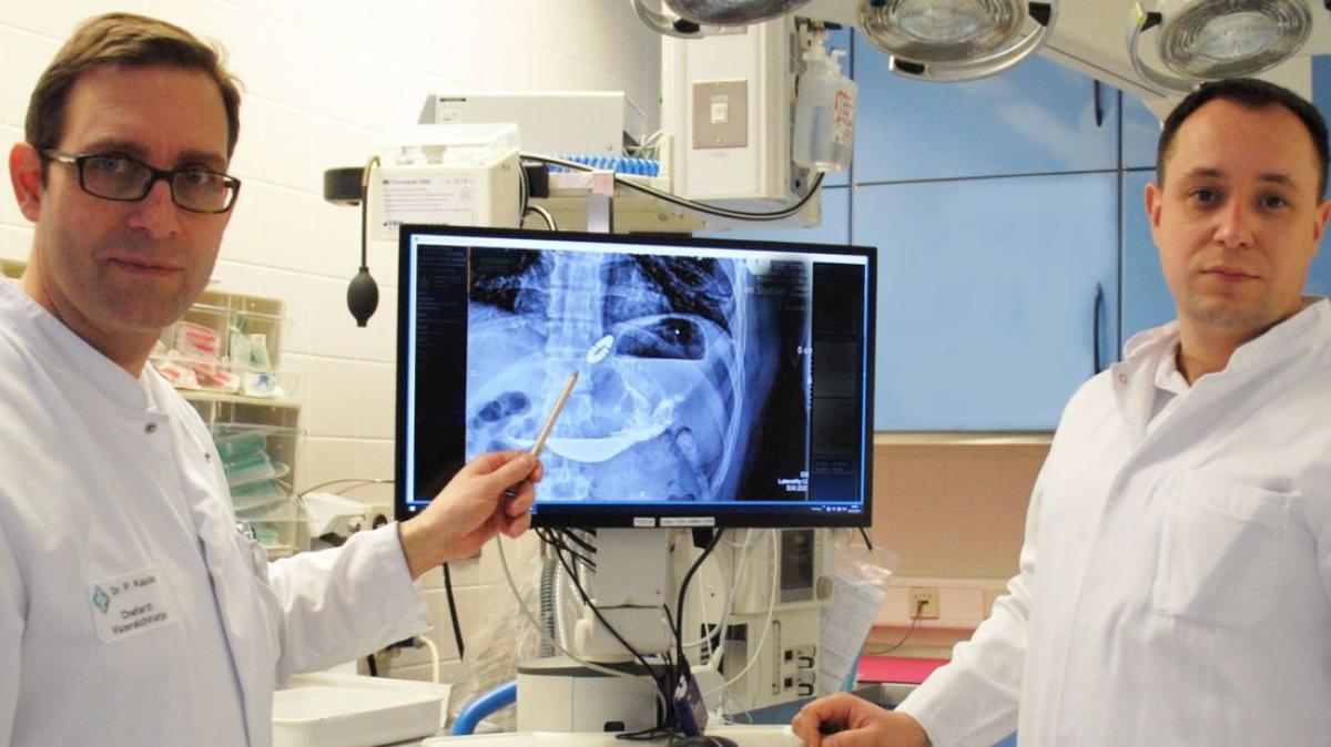 Neues OP-Verfahren am Krankenhaus Meppen bei Sodbrennen