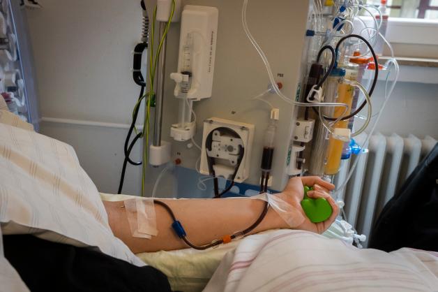 HELP-Apherese bei Post-Covid: Osnabrücker Ärzte glauben an Erfolg