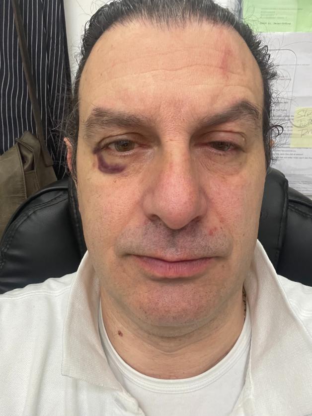 SPO: Video von Polizeieinsatz sorgt für Aufregung