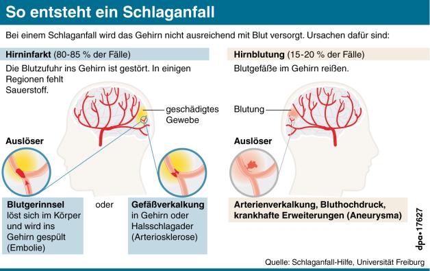 Schlaganfall erkennen und behandeln im Krankenhaus Quakenbrück
