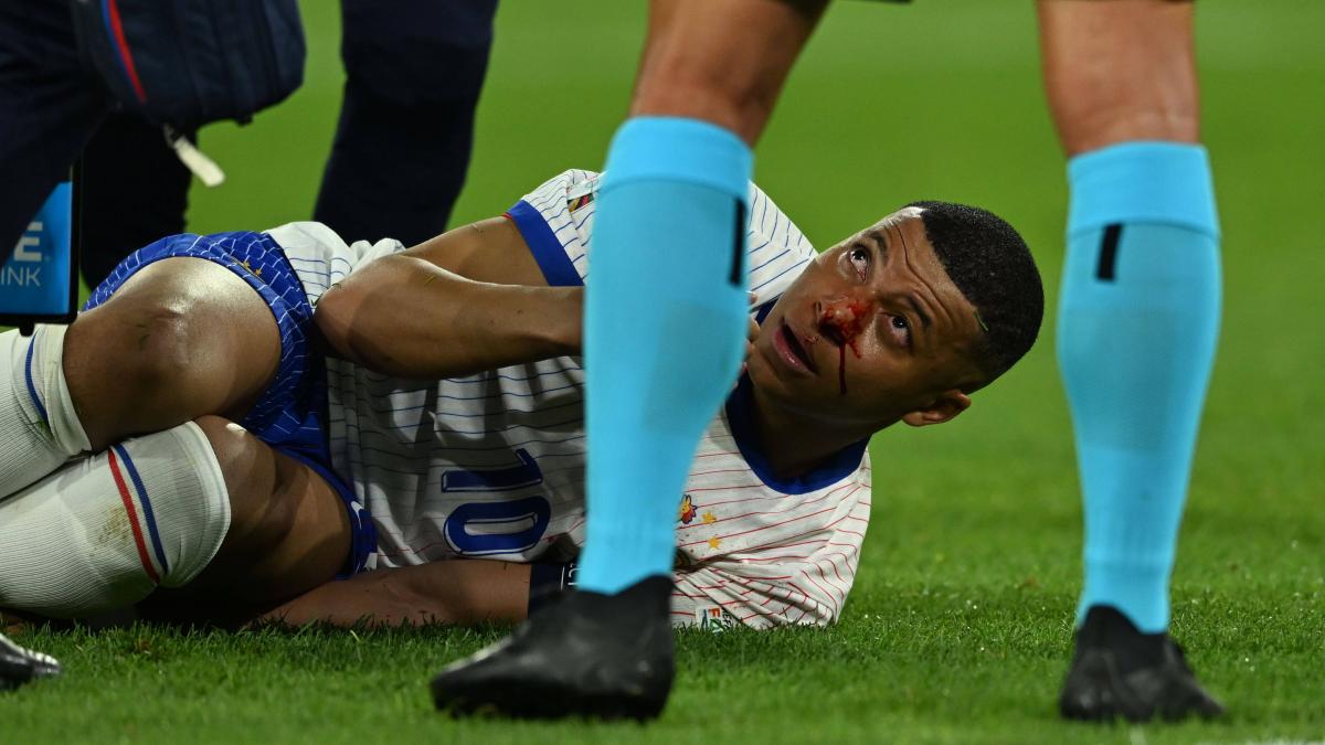 EM 2024: Mbappé mit Nasenbeinbruch – wie es für ihn weitergeht | DKO