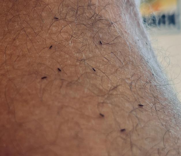 Gewitterfliegen: Woher sie kommen und warum sie uns gern kitzeln